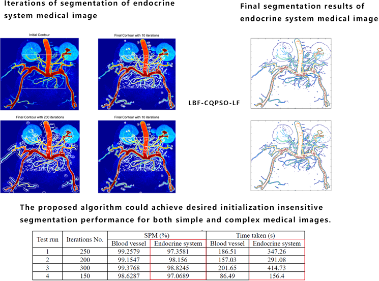 Level set medical image segmentation aided by cooperative quantum particle optimization with ...
