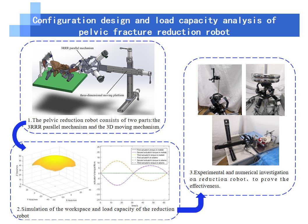 Configuration design and load capacity analysis of pelvic fracture reduction robot - Extrica