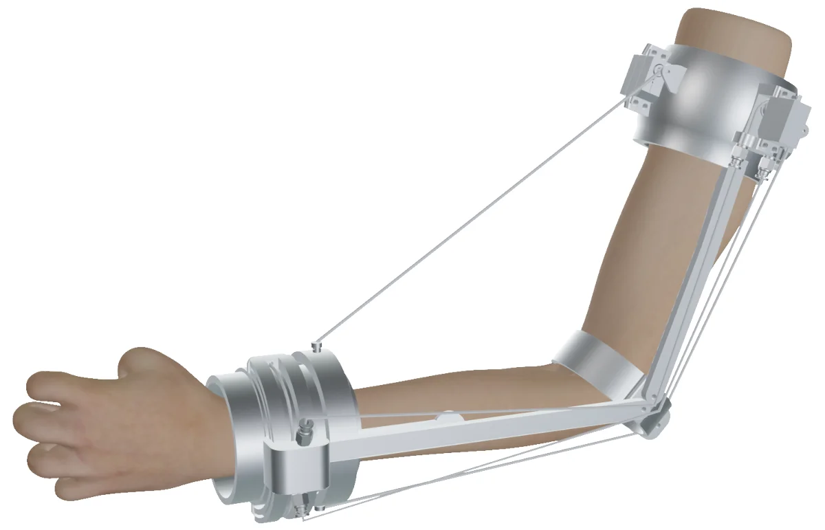 Design and simulation of a cable-driven elbow rehabilitation device ...